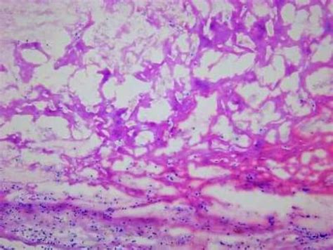 Novus Biologicals Heart Aorta Tissue Slides Heart Disease Frozen 5