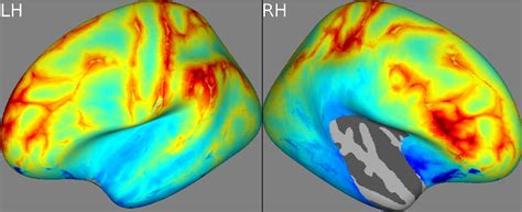 Missing Data In Fsaveragesurface Output Of Fmriprep Neurostars