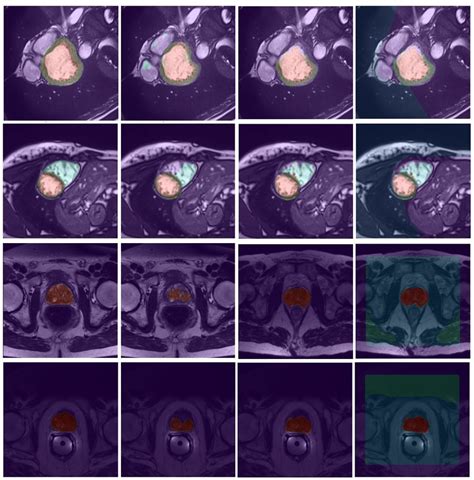 Visual Results From Left To Right Ground Truth Baseline Ours And