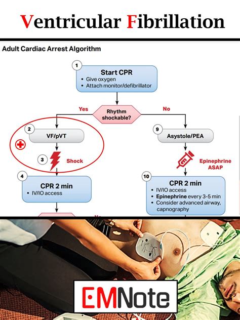 Ventricular Fibrillation Cardiac Arrest Algorithm