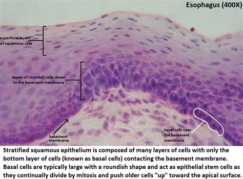 Epithelium Squamous Srathaithe Lipéadaithe