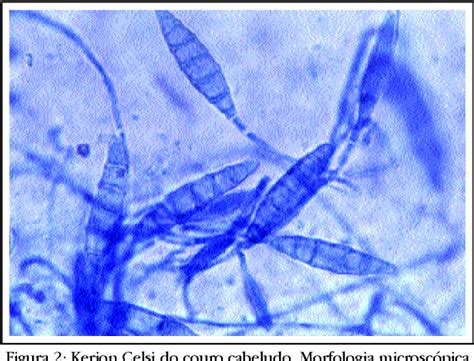Microsporum Gypseum