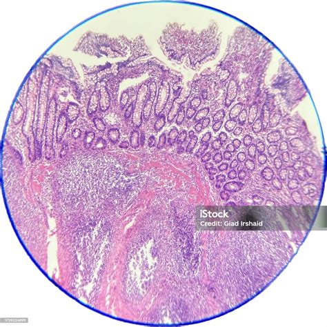 Ileum Sec Showing Goblet Cells And Intestinal Glands Stained By