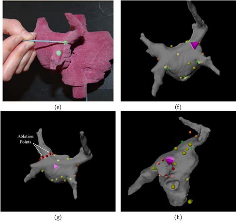 figure 9 from an event driven distributed processing architecture for image guided cardiac