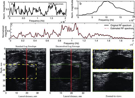 Performance Analysis Of The Md Bmcflms Algorithm For The In Vivo