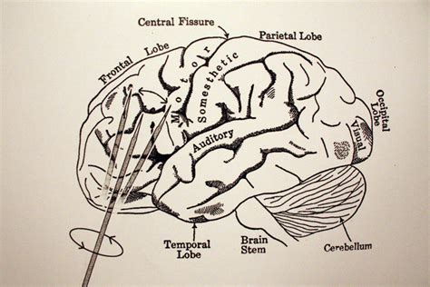 Frontal Lobotomy Diagram