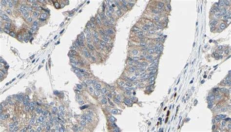 Alpha Actinin 1 Polyclonal Antibody Invitrogen™ 100 μl Unconjugated
