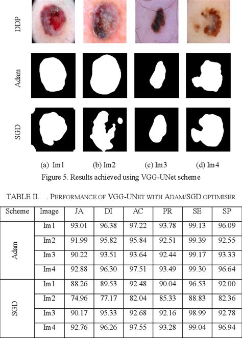 Figure 1 From Skin Melanoma Segmentation Using Vgg Unet With Adam Sgd