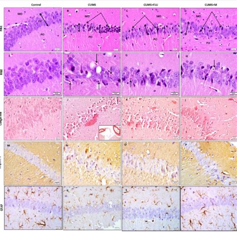 The Hippocampal Ca1 Is Formed Of The Molecular Layer Mo The