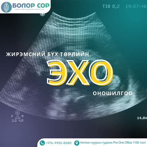 ЖИРЭМСНИЙ БҮХ ТӨРЛИЙН БОЛОР СОР эмэгтэйчүүдийн эмнэлэг