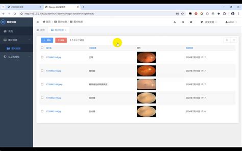 基于python深度学习的眼疾识别系统实现 知乎