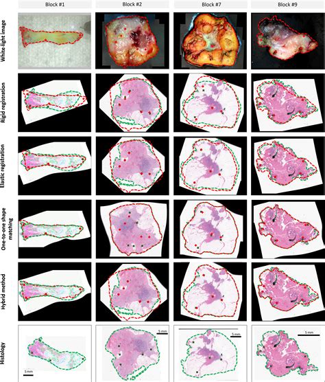 Method For Accurate Registration Of Tissue Autofluorescence Imaging Data With Corresponding
