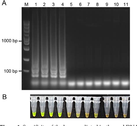 Figure 1 From A Loop Mediated Isothermal Amplification Assay For The Rapid Detection Of