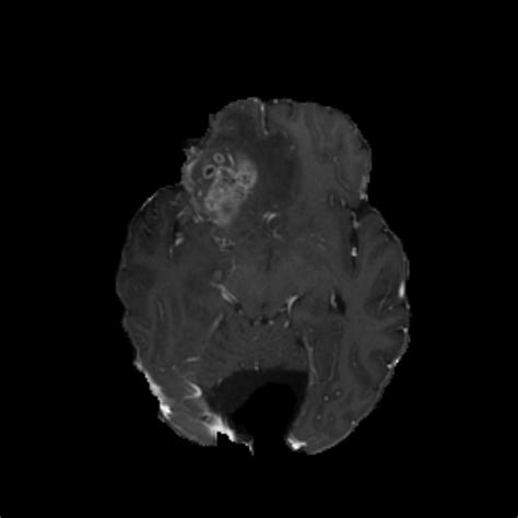 Axial Dataset Object Detection Dataset By Tfg