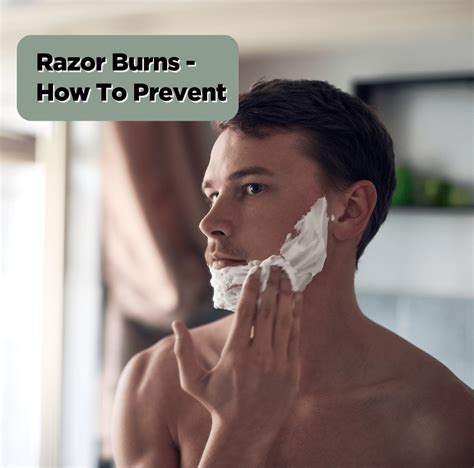 How To Prevent Razor Burn – SGPomades