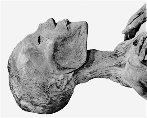 The History Of The Smallpox Vaccine Ask A Biologist