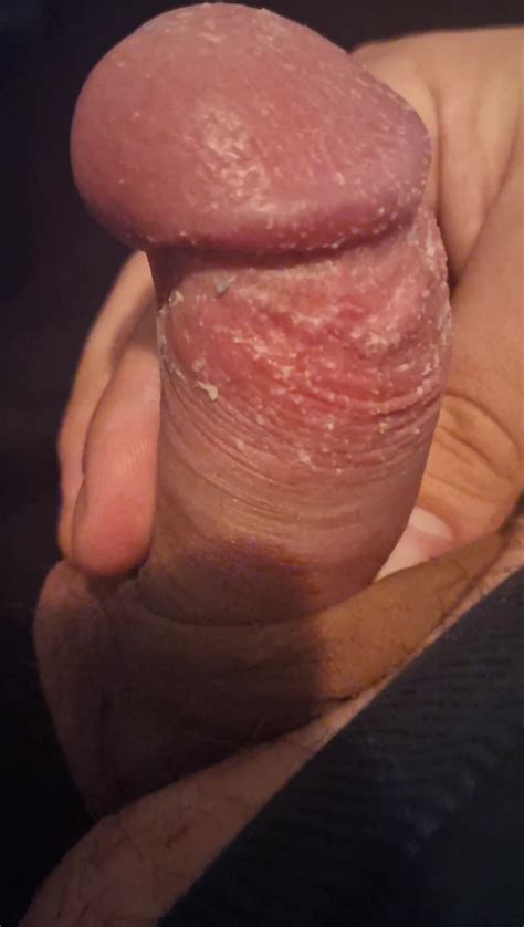 Showing My Nasty Cheesy Cock Thisvid Com