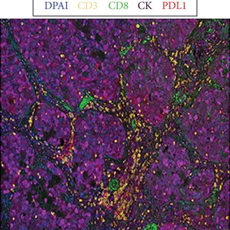 Multiplex Immunofluorescence Staining And Multispectral Imaging To