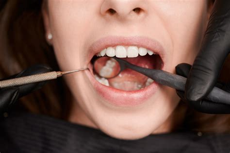 Tooth Pulp Exposed Causes Symptoms And Treatment