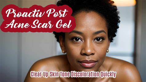 Scar Acronym Medical At Eleanor Noel Blog