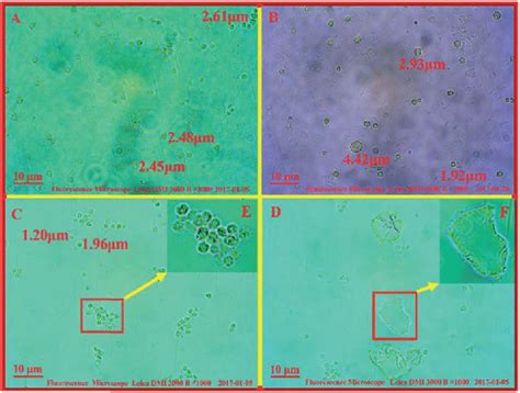 Microalgae Cell Morphology Was Imaged By Bright Field Fluorescence Download Scientific Diagram
