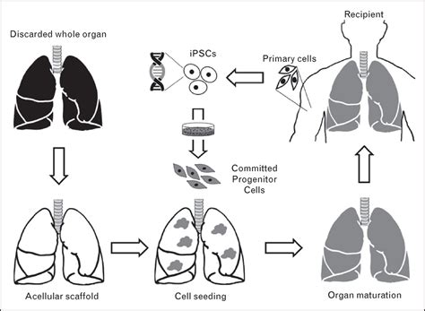 Recellularization Of Organs What Is The Future For Solid Or