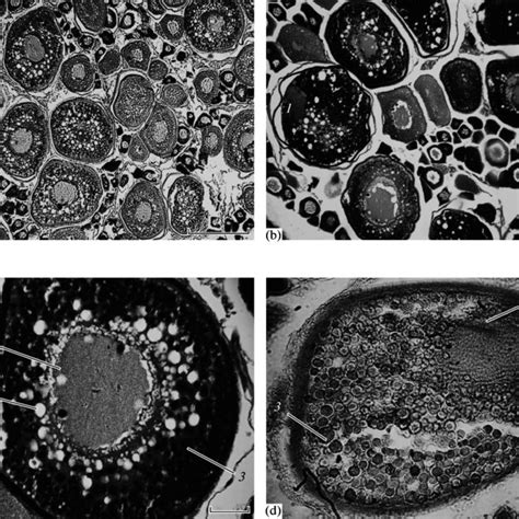 Normal Condition Of Sex Cells In The Females Of Manybar Goatfish Download Scientific Diagram
