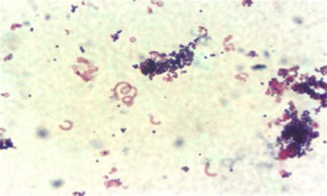 Halobacterium Gram Stain