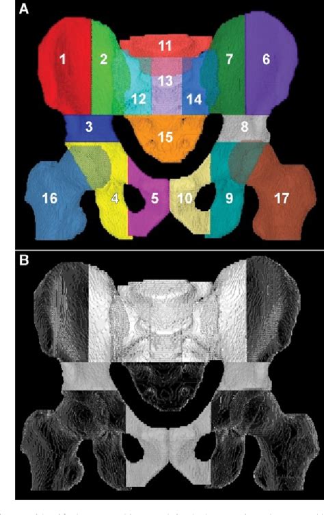 Figure 2 From Spatial Mapping Of Functional Pelvic Bone Marrow Using