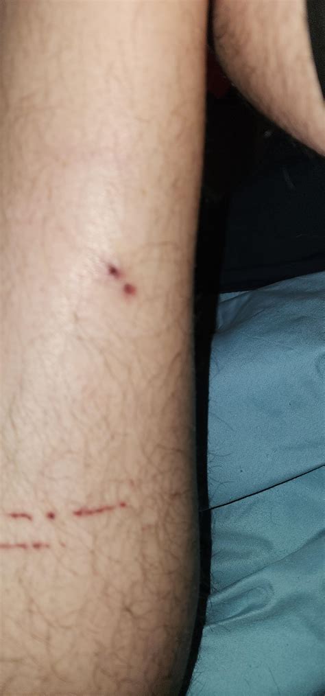 Copperhead Bite When Is A South Carolina Copperhead Likely To Bite