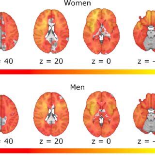 Lesion Overlap Maps For Women And Men Spatial Correlation Between The Download Scientific