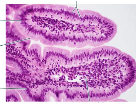 Duodenum Ii Diagram Quizlet