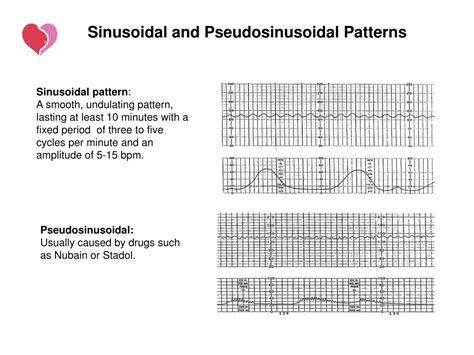 Ppt Antepartum Fetal Monitoring Powerpoint Presentation Free