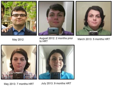 24 Mtf 9 Months Hrt Mtf Hrt Mtf Hrt
