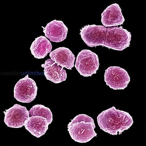 Archaebacteria Halophiles Ppt Archaebacteria And Eubacteria In