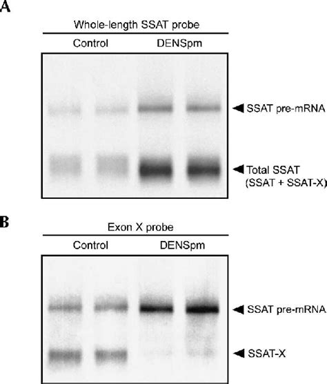 Northern Blot Analysis Of Ssat Mrna Expression Mt Ssat Transgenic Mice Download Scientific
