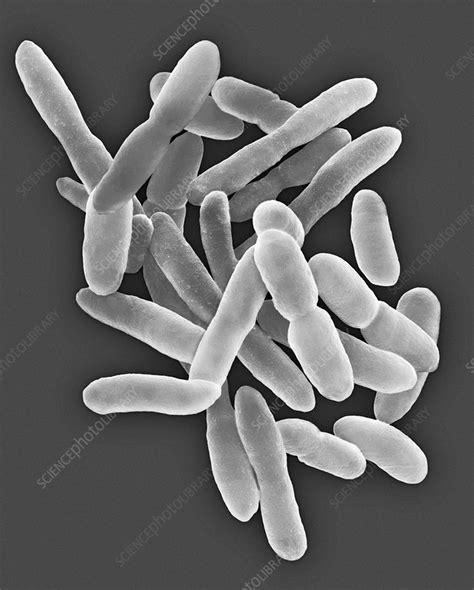 Arthrobacter Sp Sem Stock Image C037 0130 Science Photo Library
