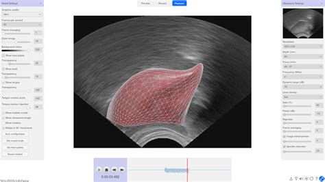 Ultrasound Tongue Imaging