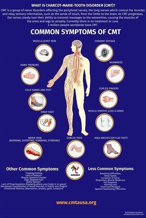 The Common Symptoms Of Cmt Info Poster On Blue Background With Information About It