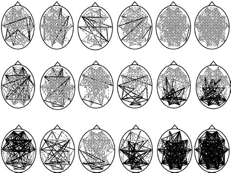 Statistically Significant Differences In EEG Coherence In The Frequency Download Scientific