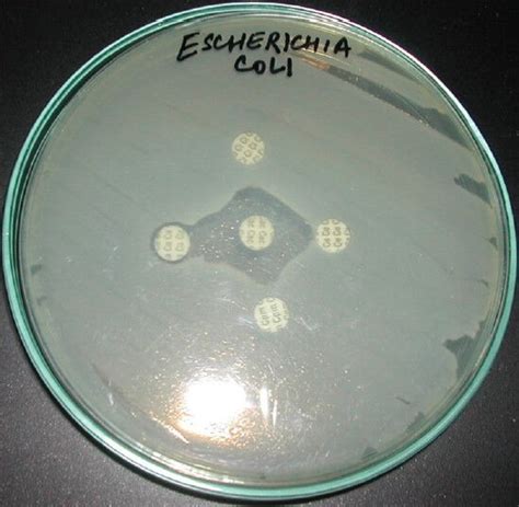 Photograph Showing Detection Of Extended Spectrum β Lactamases By Using Download Scientific