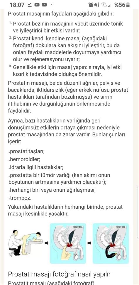 Prostat Masajı Yaptırır Mısın KizlarSoruyor