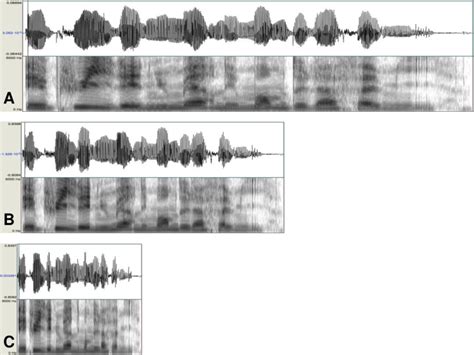 Waveforms And Spectrograms Of One Sentence At Its Normal Duration A