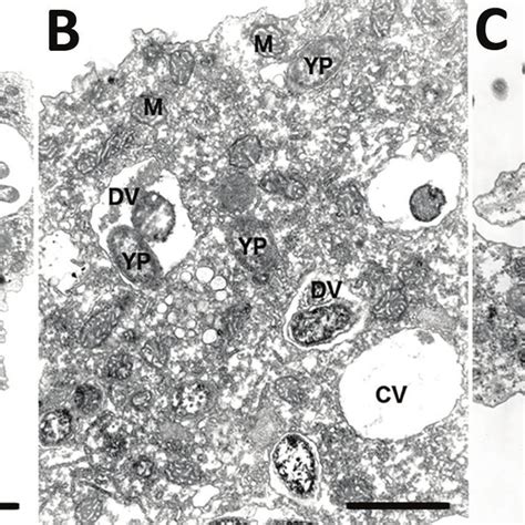 Representative Transmission Electron Micrographs Tem Depict Download Scientific Diagram