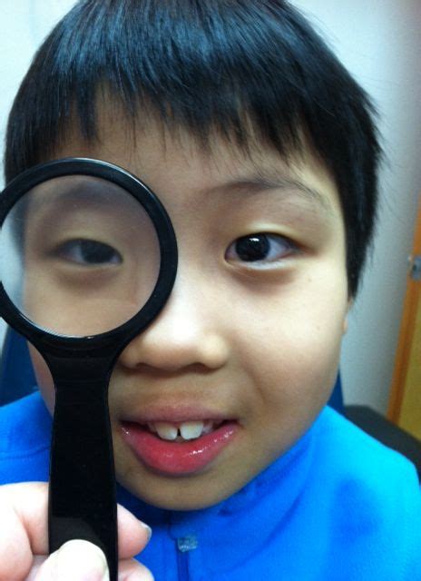 Ocular Discriminative Movement Part 2 Ocular Movement Vision Therapy