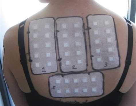 Services Second Skin Dermatology