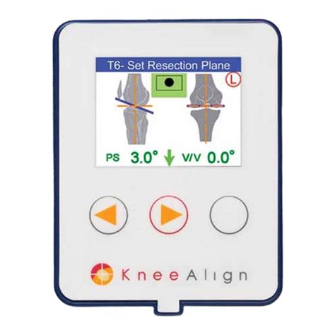 Orthalign Kneealign 2 System Technique Manual Pdf Download Manualslib