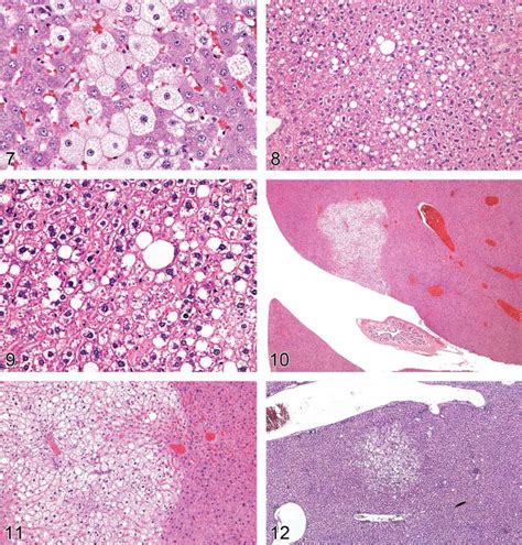 Proliferative And Nonproliferative Lesions Of The Rat And Mouse Hepatobiliary System