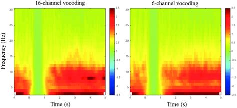 Time Frequency Representation Of The Eeg Activity Averaged Across All Download Scientific