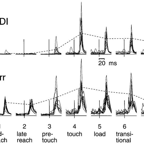 Examples Of Tms Evoked Emg Responses In 1di And Brr Obtained From A Download Scientific Diagram